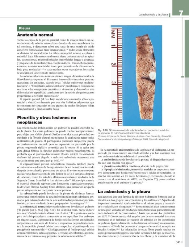 Patología Quirúrgica del Tracto Gastrointestinal / 2 Tomos /Robert D ...